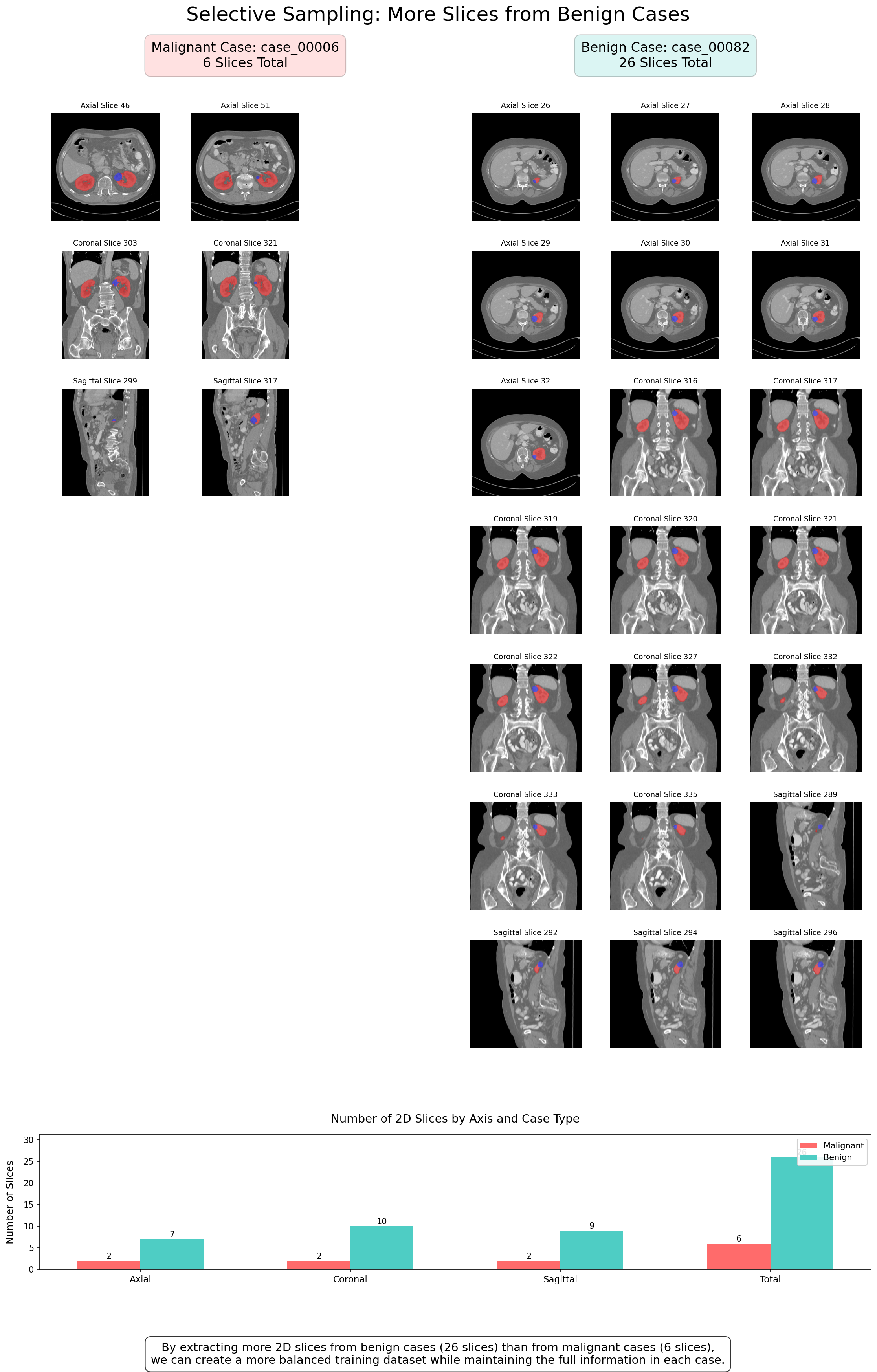AI for Kidney Tumor Classification | TendersLab